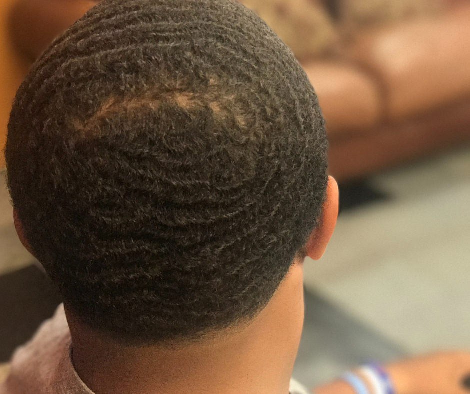 9 Scalp Care Tips for Summer– EDH SIGNATURE